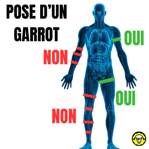Comment appliquer un garrot tourniquet CAT : guide débutant - Mouton ...