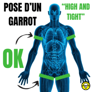 Comment appliquer un garrot tourniquet CAT : guide débutant - Mouton ...